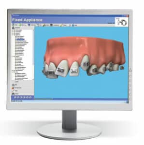Patient-Education Software | Orthodontic Products