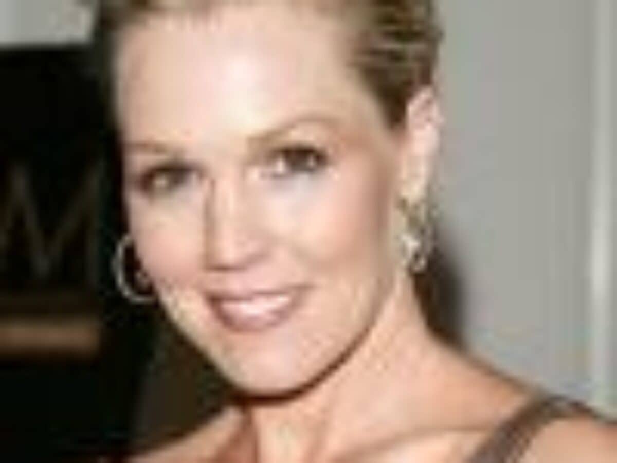 Invisalign Actress 60 Photos - Moonagedaydream.film