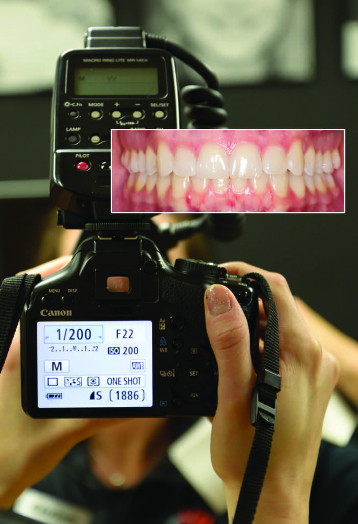 Getting the Perfect Photo - Orthodontic Products