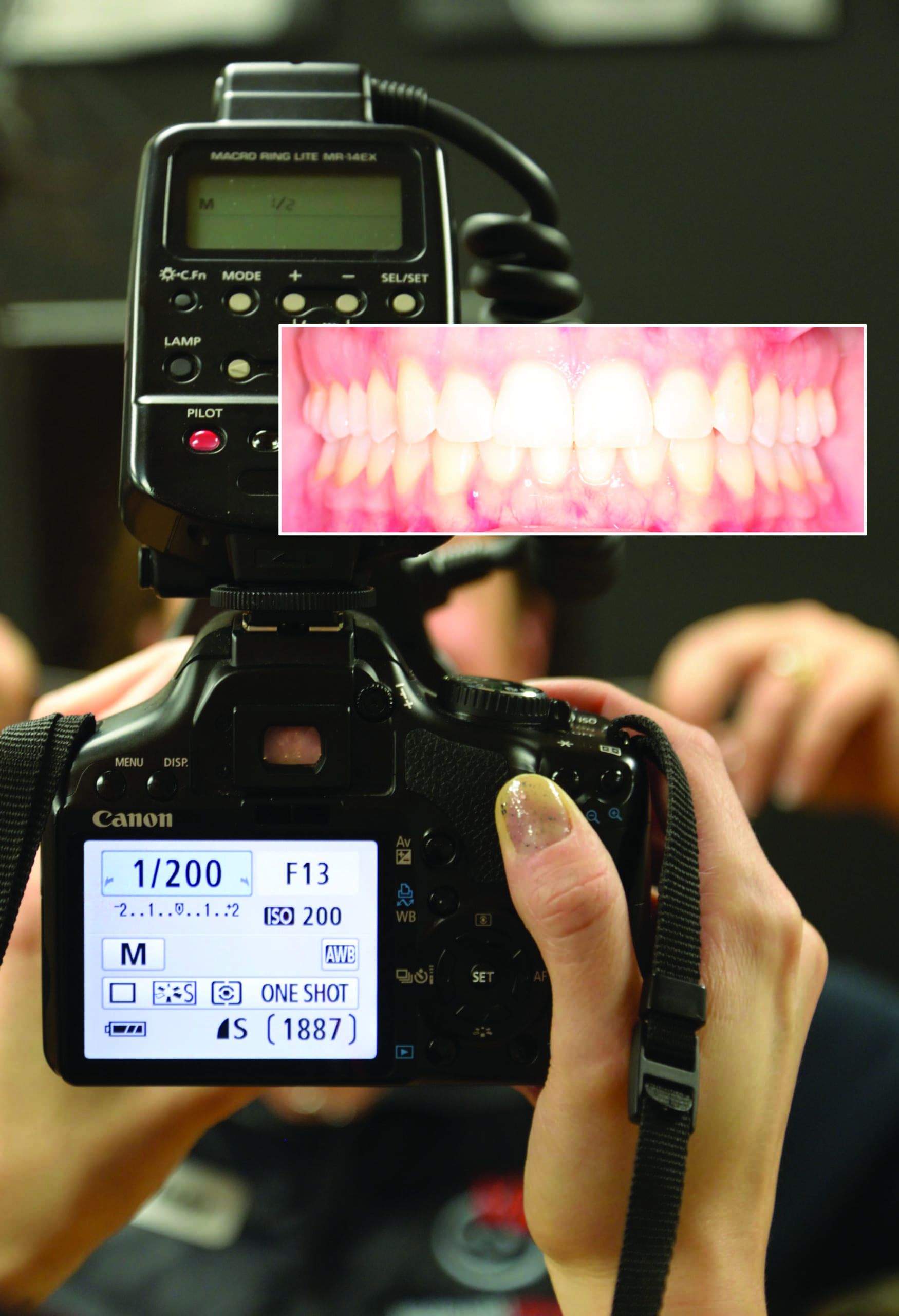 Getting the Perfect Photo - Orthodontic Products