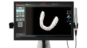 3M Digital Oral Care Unveils New 3M True Definition Scanner ...