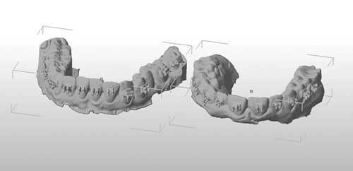 Digitally Streamline Debanding and Retention | Orthodontic Products