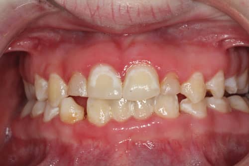Oral Hygiene and the Special Needs Patient | Orthodontic Products