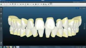 Digital Tech From Start to Finish | Orthodontic Products