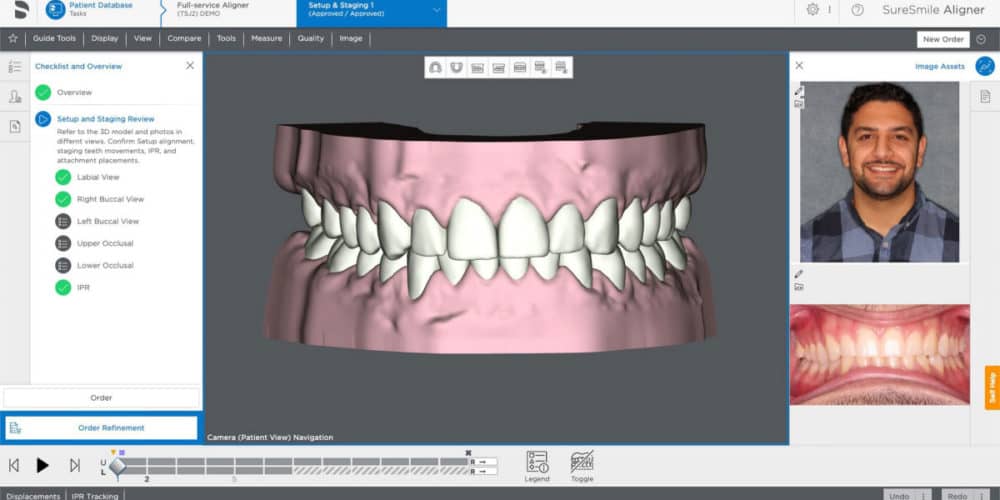 First Look at SureSmile 7.6 Showcases More Clinician Controls ...