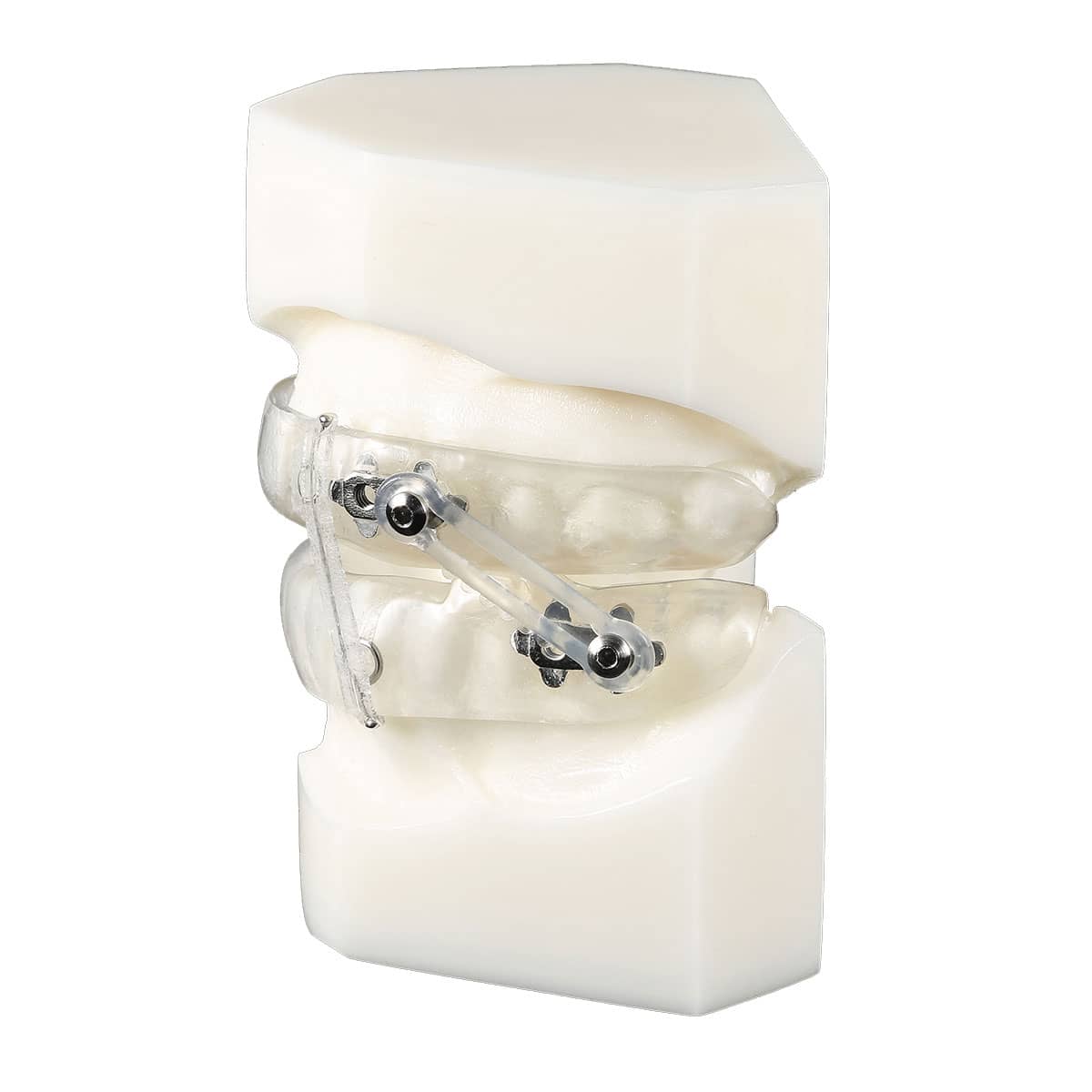 Special Focus: Oral Appliances for Snoring and Sleep Apnea ...