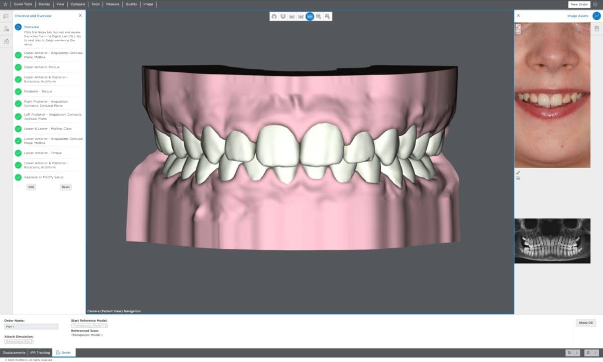 Software Pro Tip: SureSmile Digital Lab | Orthodontic Products