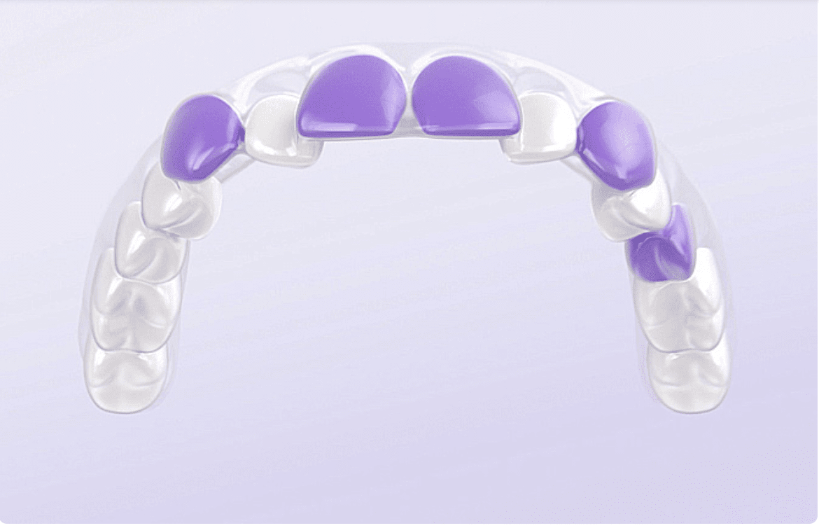 SmileDirect Makes a Deal With Anthem Blue Cross and Blue Shield ...