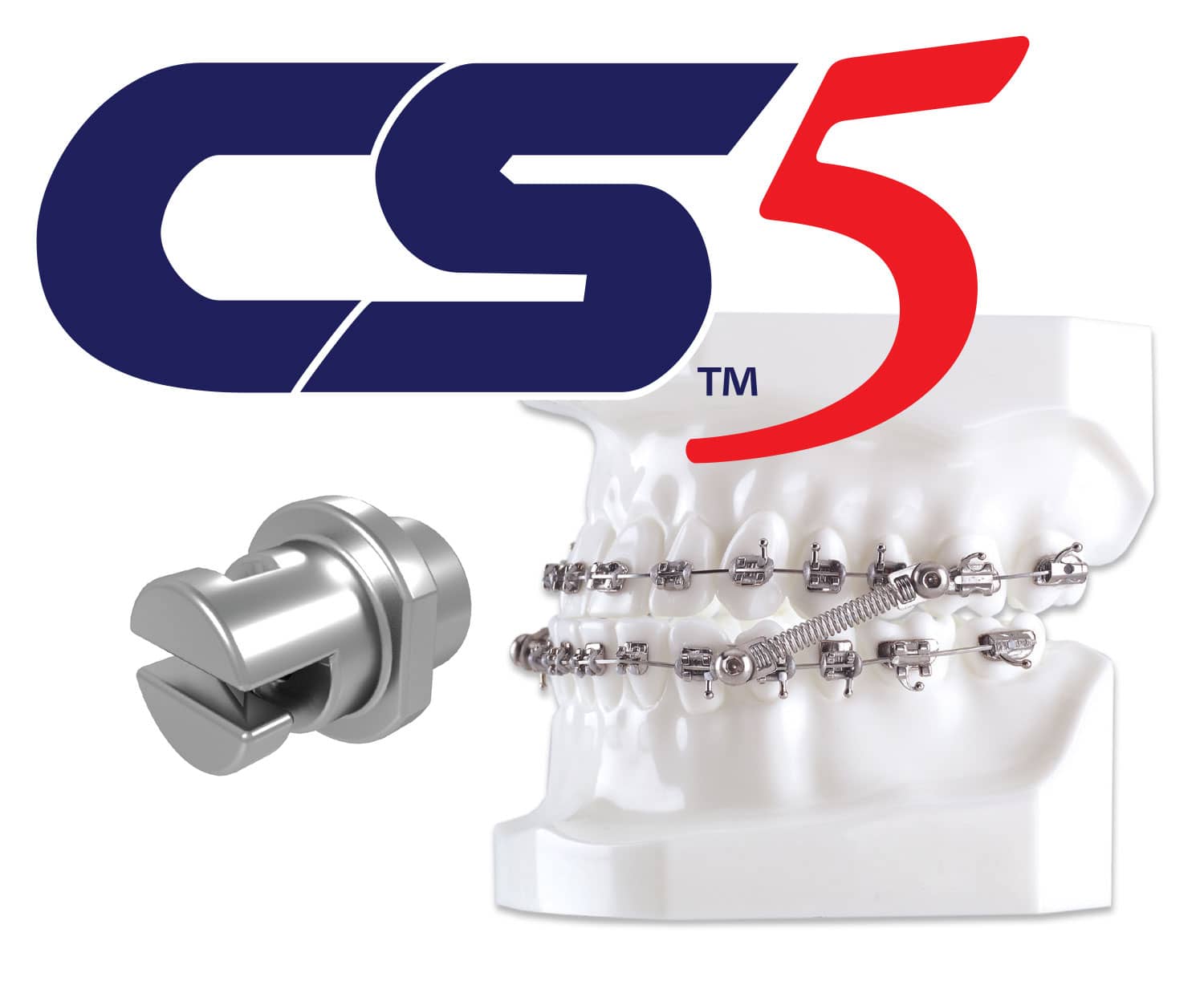 DynaFlex Releases the CS5 Class II and III Corrector | Orthodontic Products