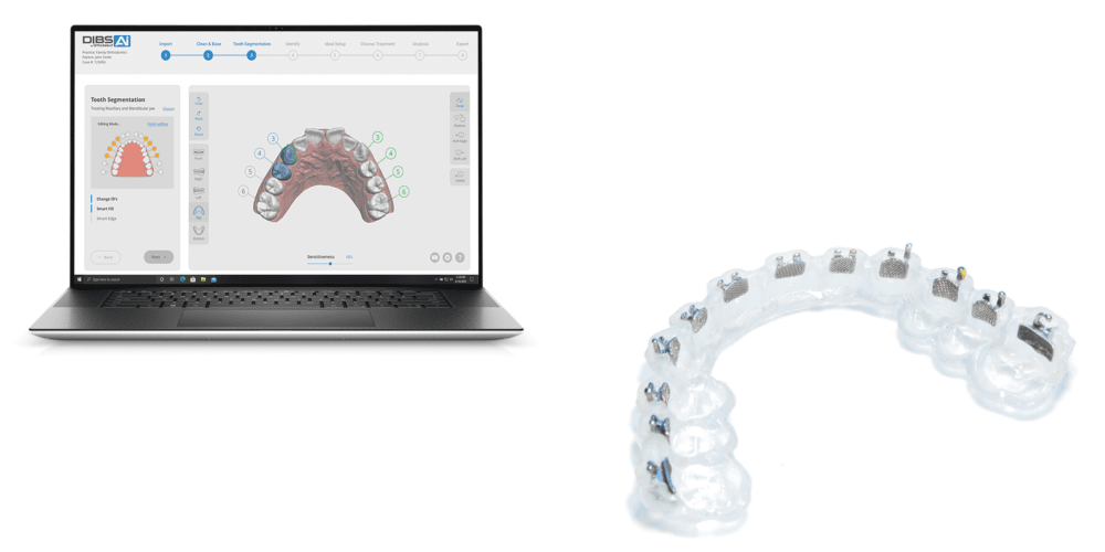 New DIBS AI Software from OrthoSelect Aims to Enhance Patient Case ...