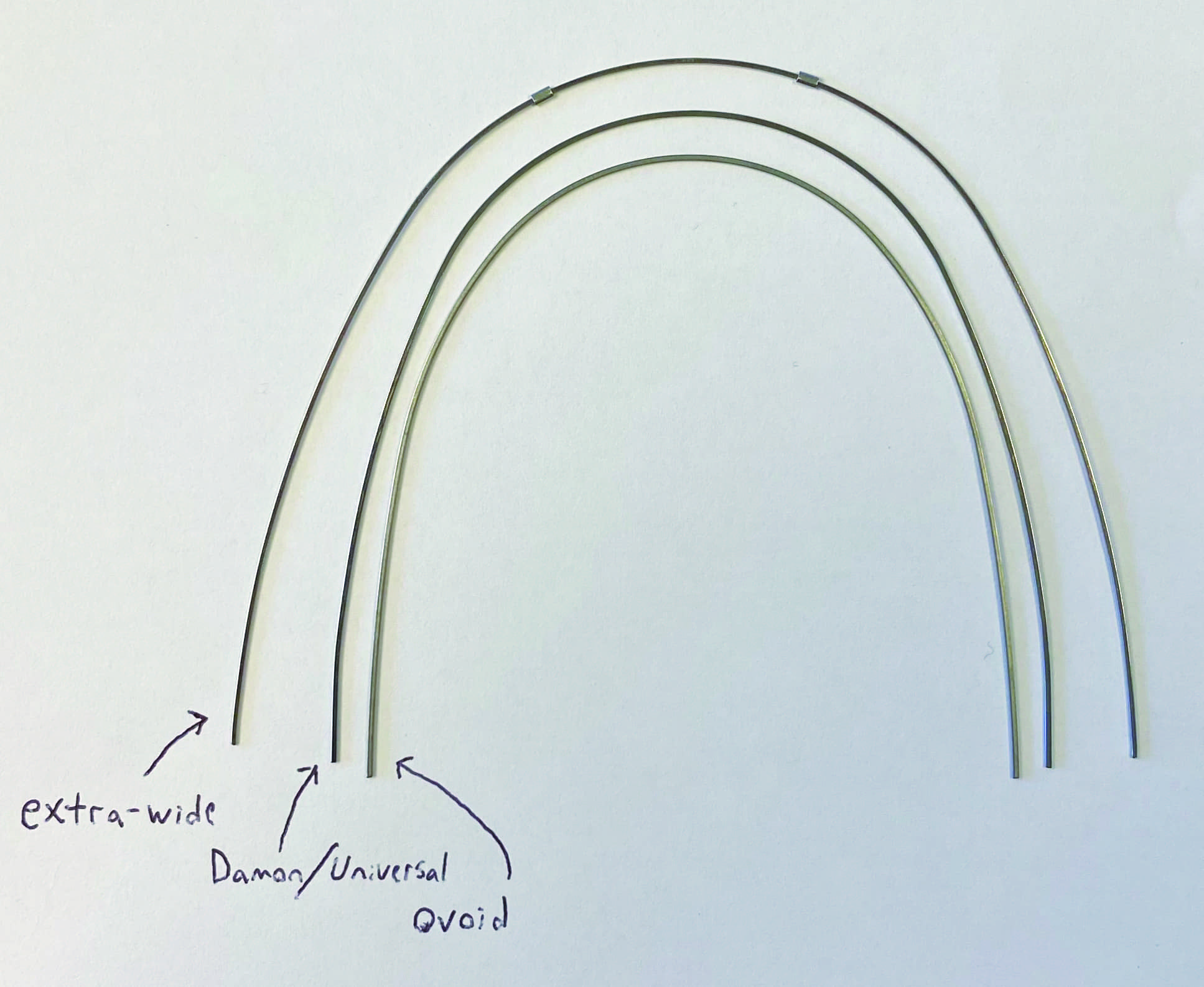 10 Clinical Tips for Non-Extraction Treatment | Orthodontic Products