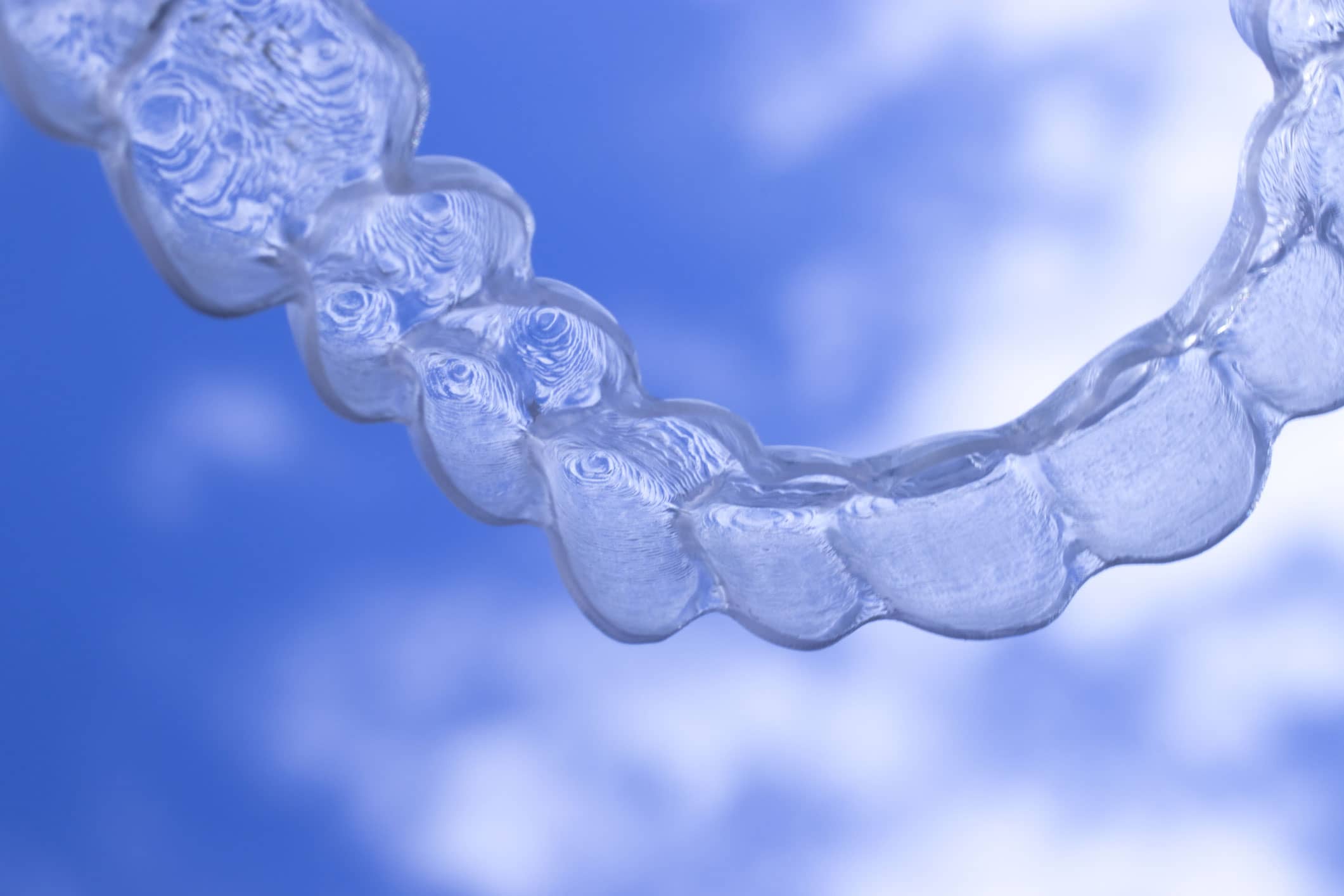 uLab Systems Moves into Aligner Production with New Manufacturing Plant ...