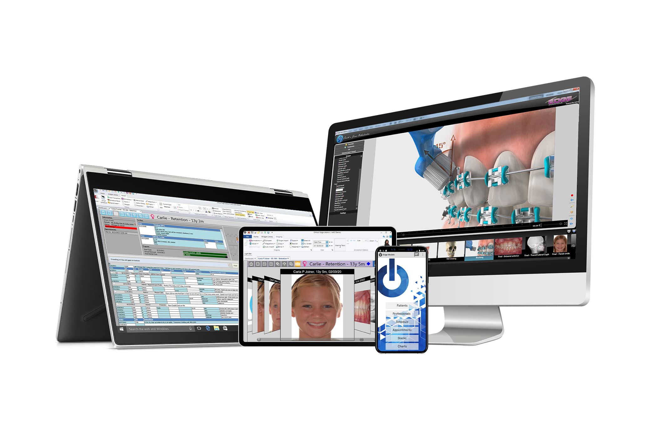 Ortho2, Orthodontic Partners Sign Exclusive Agreement on Practice ...