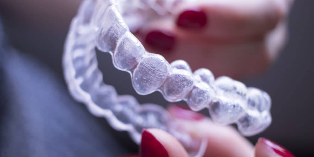 uLab Systems Marks 200,000 Clear Aligner Cases in U.S. | Orthodontic ...