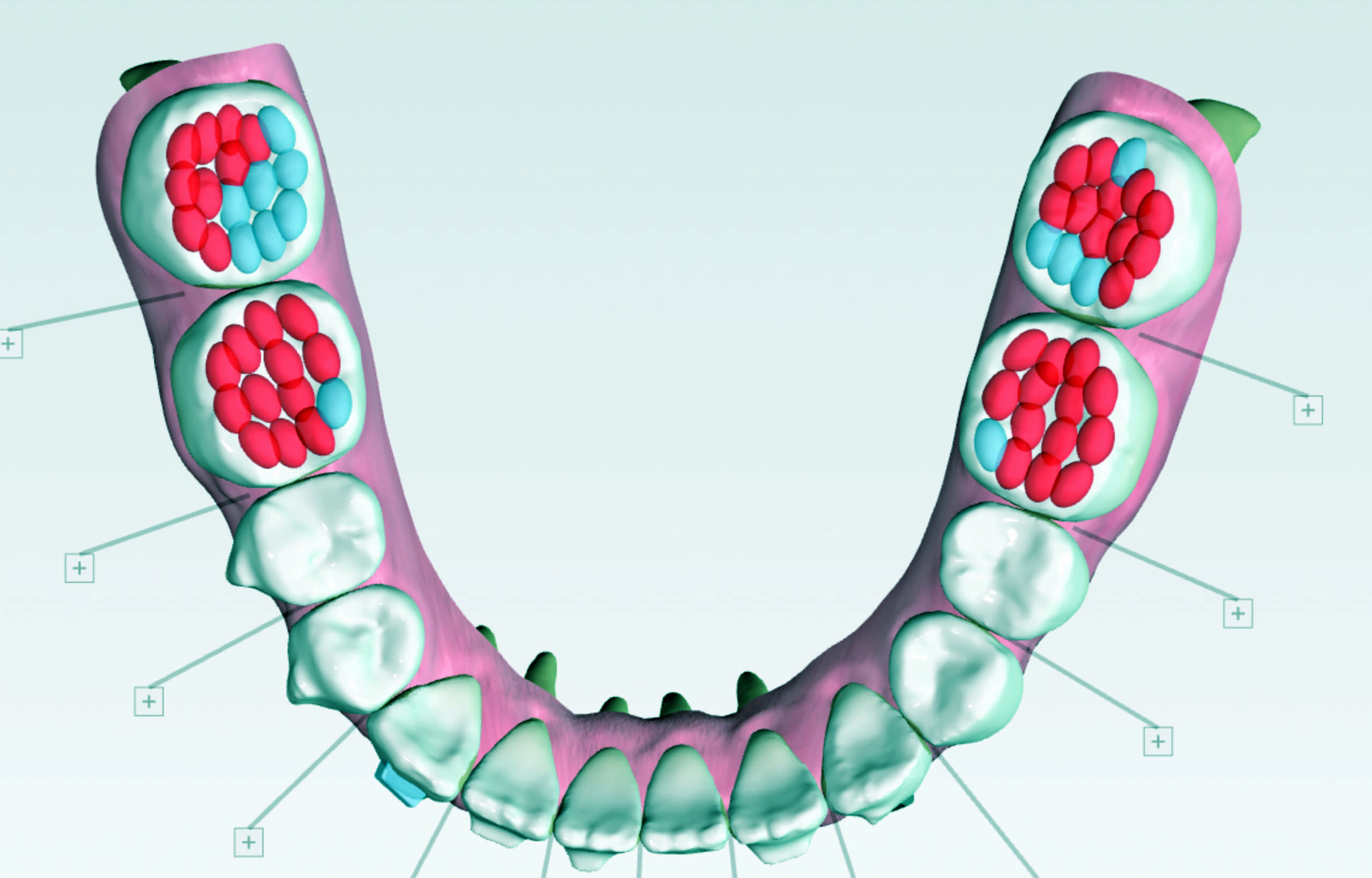 Clinical Products Spotlight: A Deep Dive into the Spark Clear Aligner ...