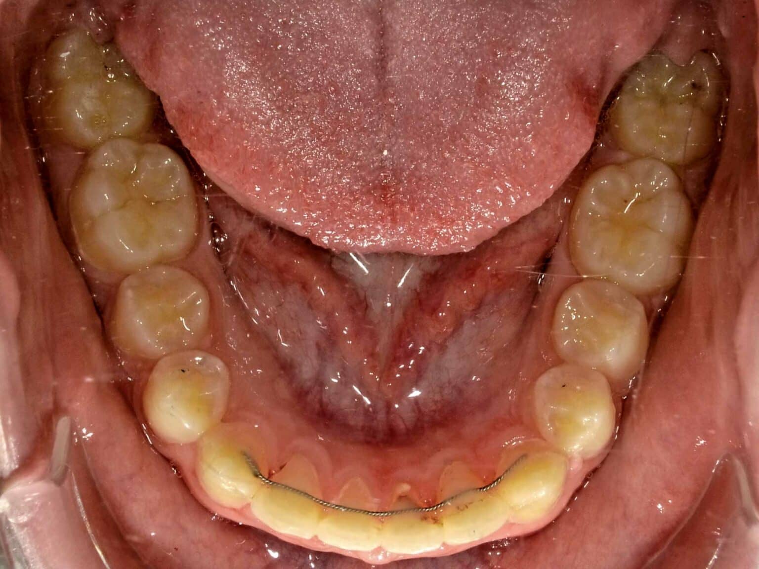 Confluence of Technologies: A Custom Bracket System and Teledentistry ...