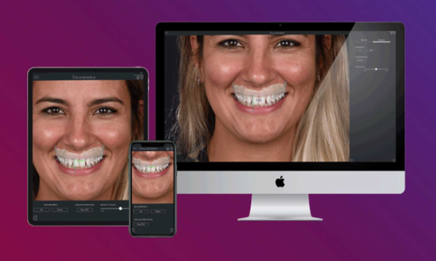 SmileFy Launches Smile Design Software | Orthodontic Products