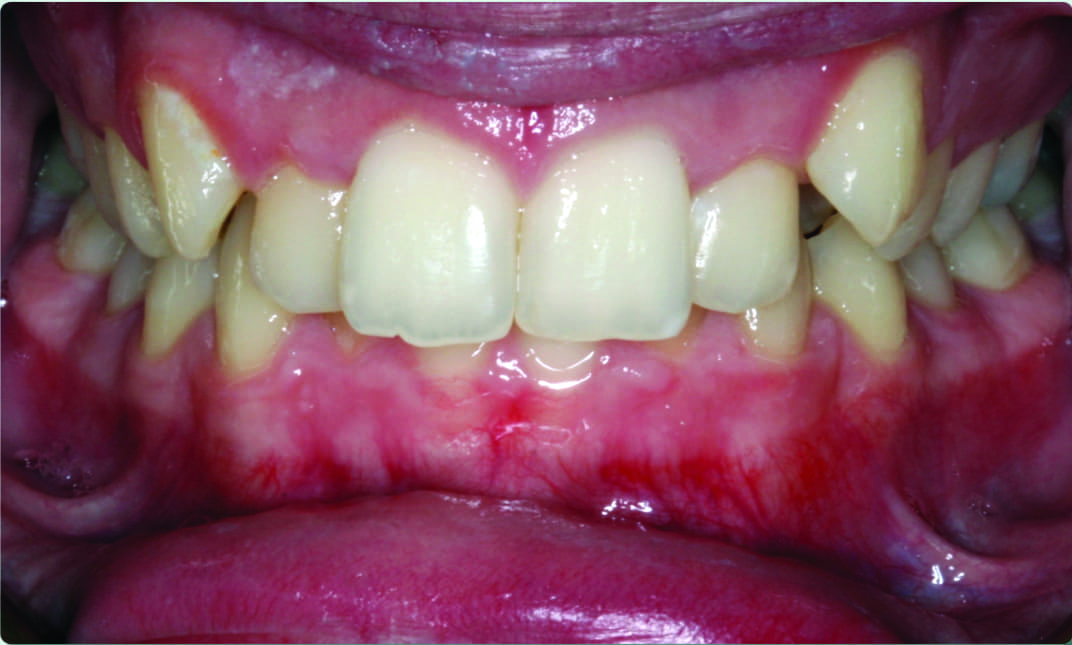 Clinical Products Spotlight: Finding the Glitz in Consistent Products ...