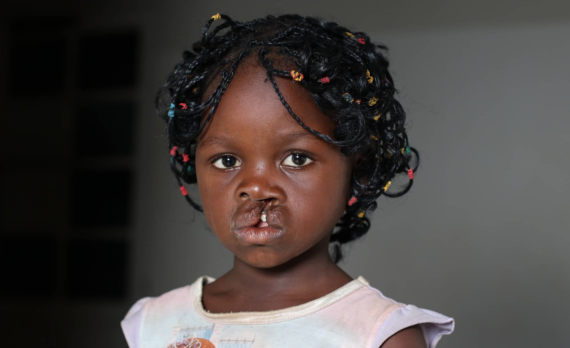 Dentsply Sirona Partners with Smile Train to Support Global Cleft Care ...