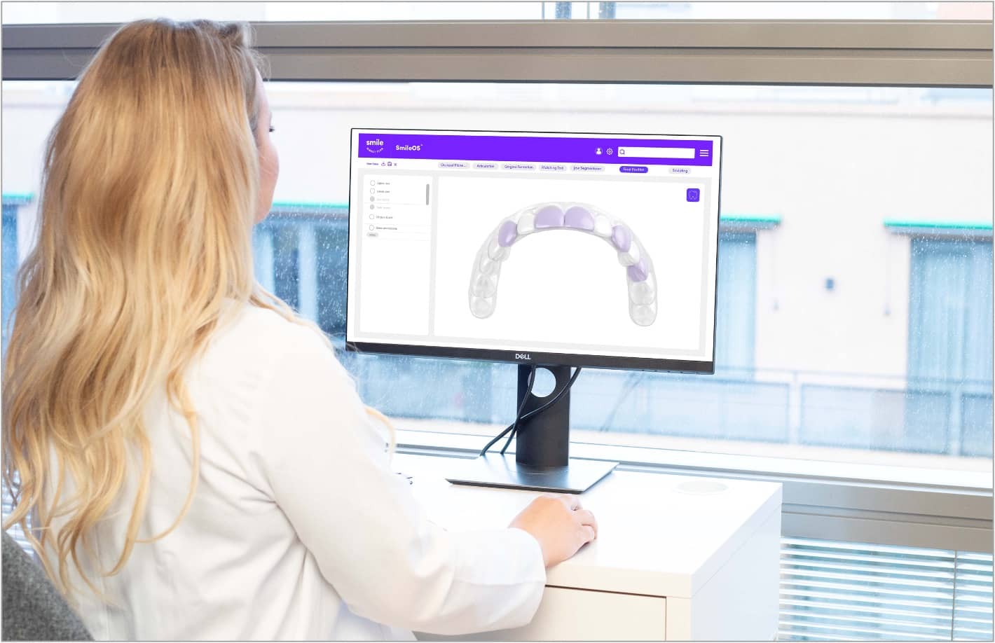 SmileDirectClub Offers Treatment Planning System with SmileOS ...