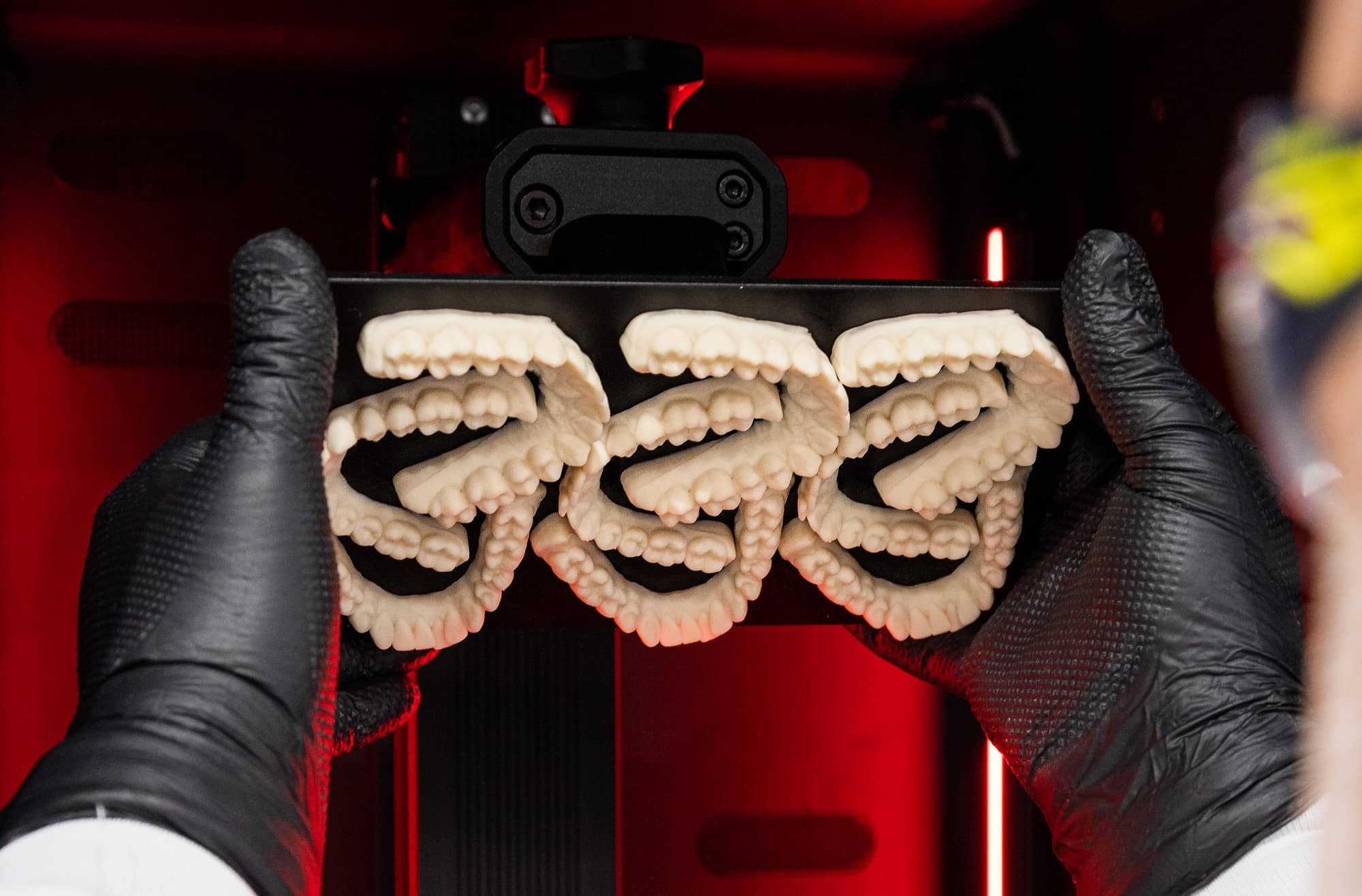 Stratasys Launches Origin One Dental 3D Printer | Orthodontic Products