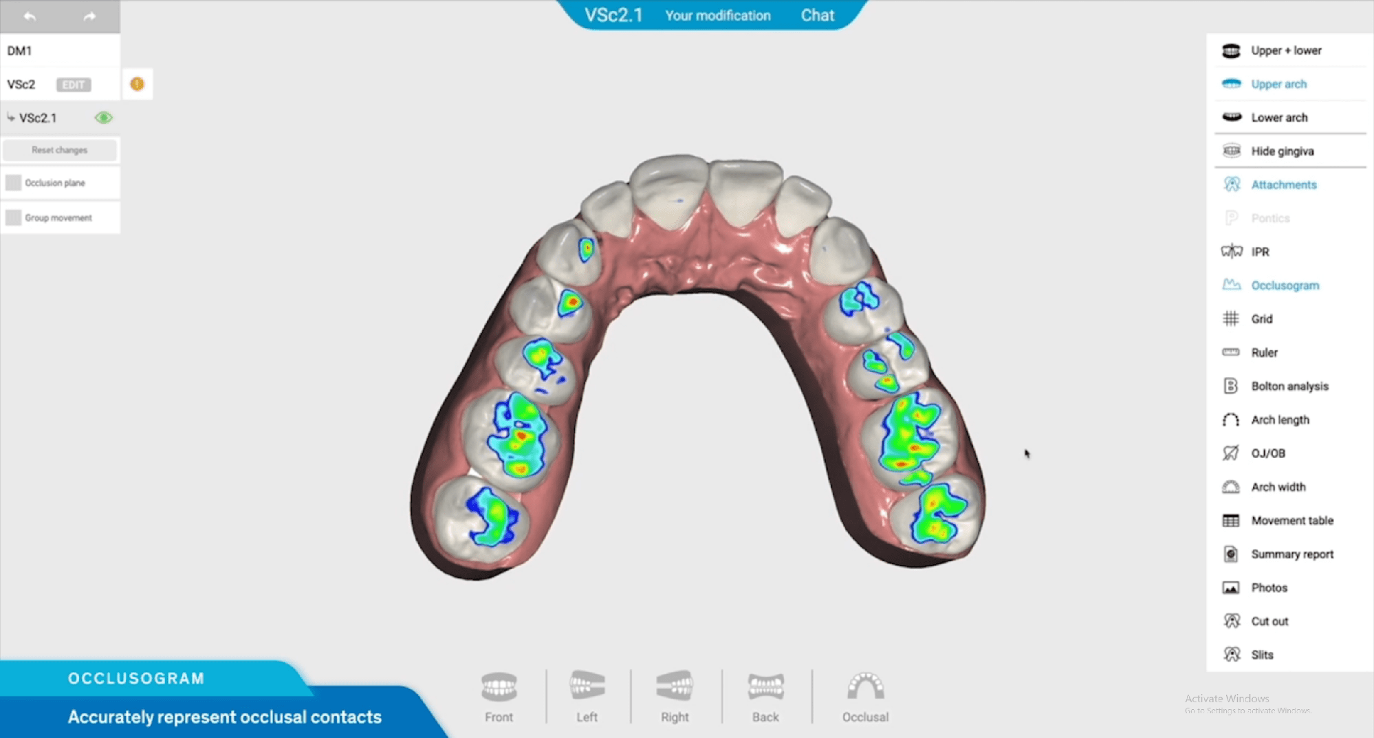 Henry Schein Orthodontics Launches Studio Pro 4.0 Treatment Planning ...
