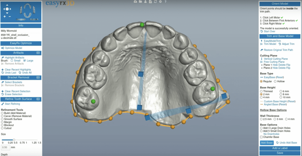 EasyRx Adds Freeform Cutting Plane to EasyRx 3D | Orthodontic Products
