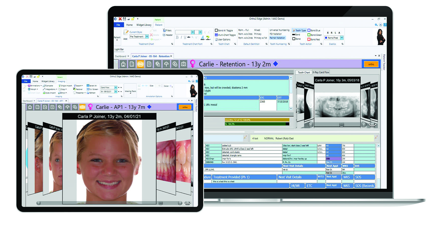 Focus on: 2022 Orthodontic Treatment Planning Software | Orthodontic ...