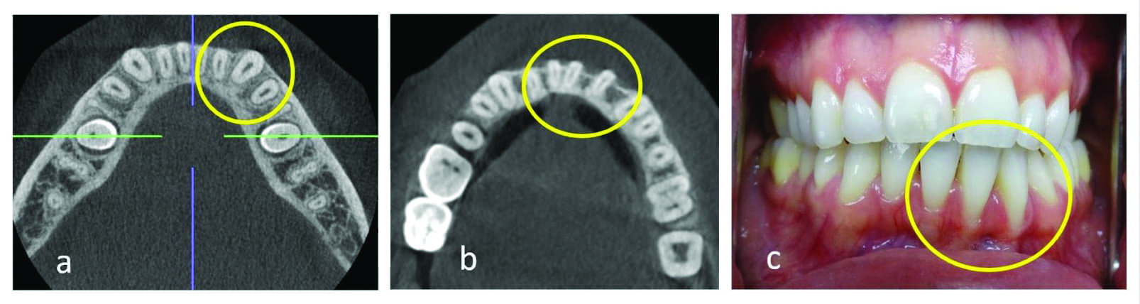 Why CBCT Is Key To Long Term Case And Professional Stability Orthodontic Products why-cbct-is-key-to-long-term-case-and-professional-stability-orthodontic-products