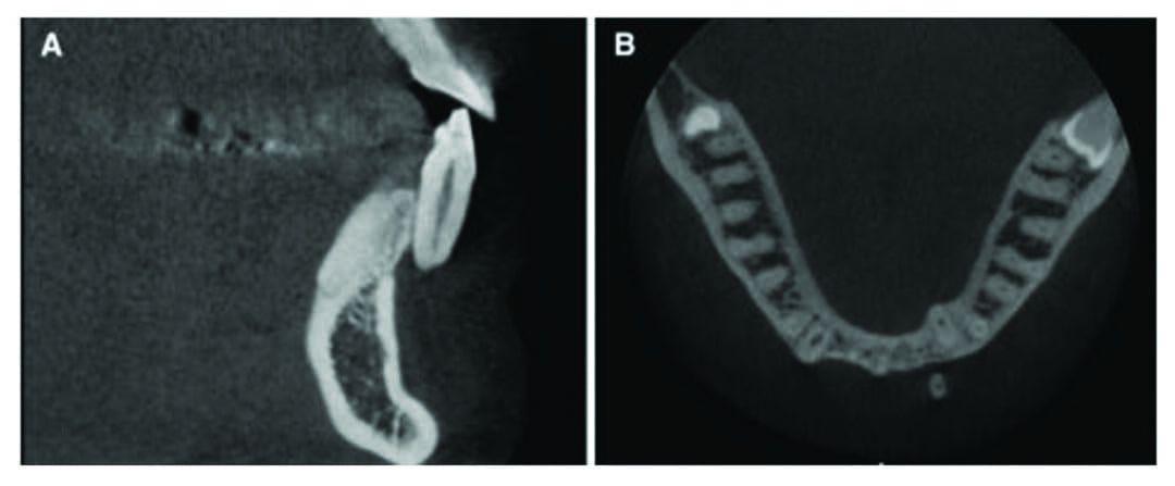 Why CBCT Is Key to Long-Term Case and Professional Stability ...