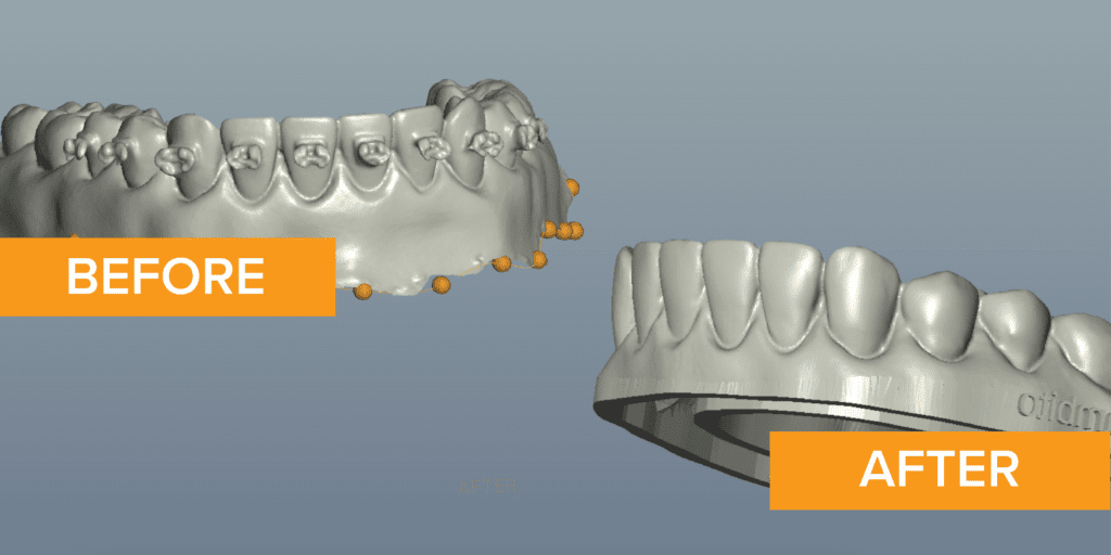 EasyRx adds 3D Automated Basing to 3D Suite | Orthodontic Products
