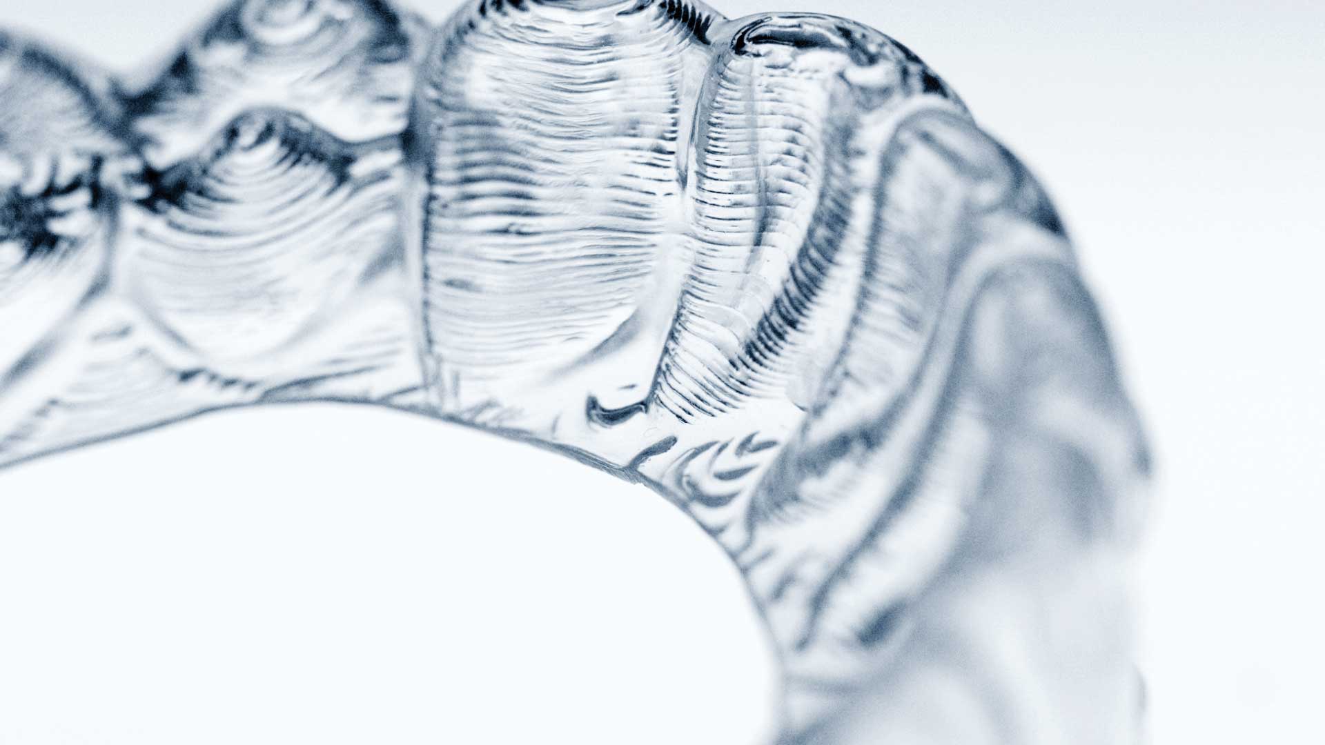 Focus On: 2022 Clear Aligner Systems | Orthodontic Products