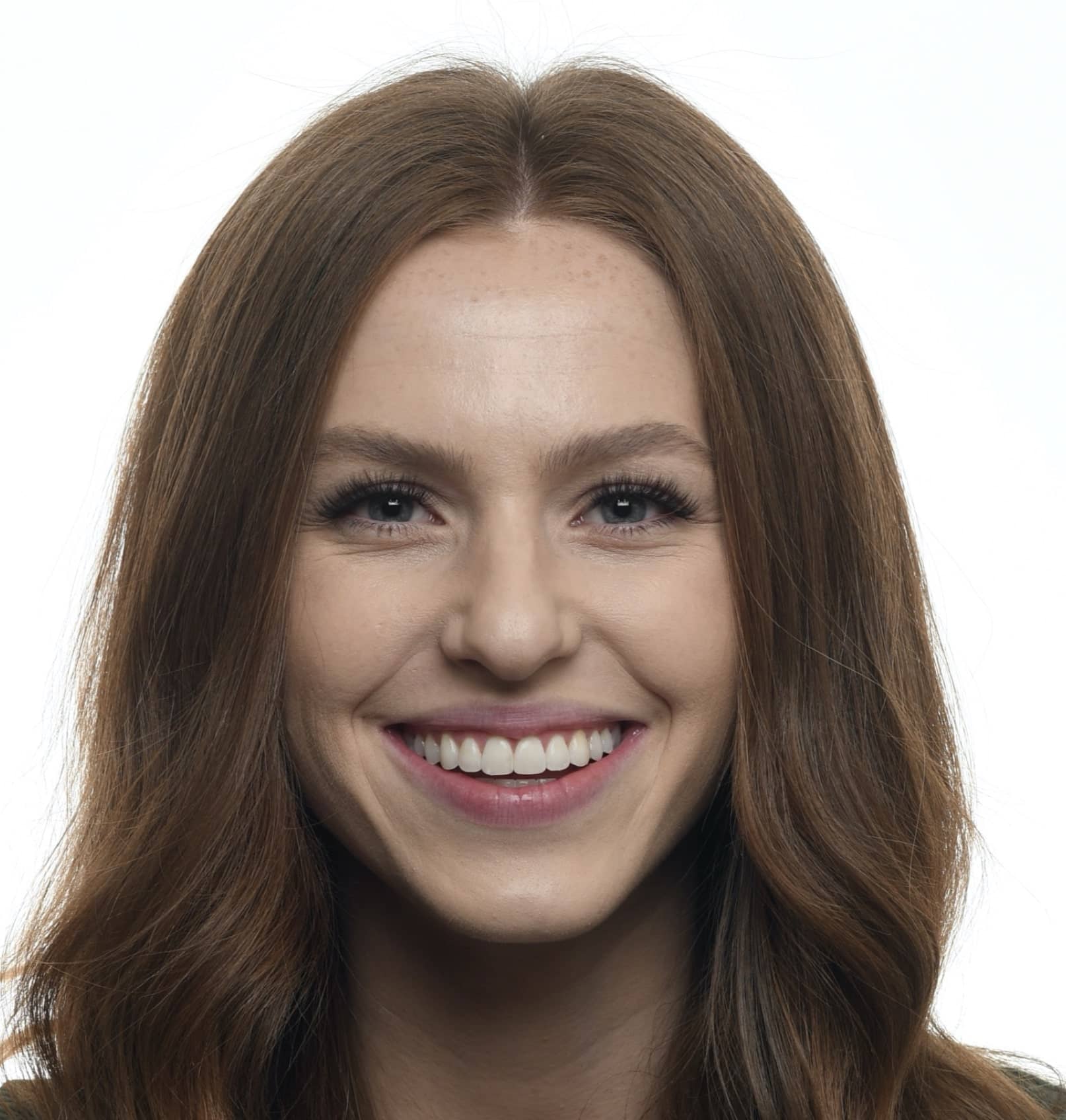 The 5 Keys to Creating Beautiful Smiles with Aligners