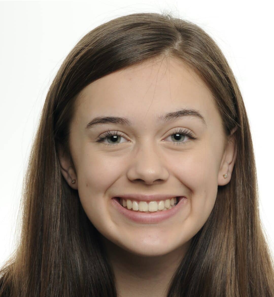 The 5 Keys to Creating Beautiful Smiles with Aligners