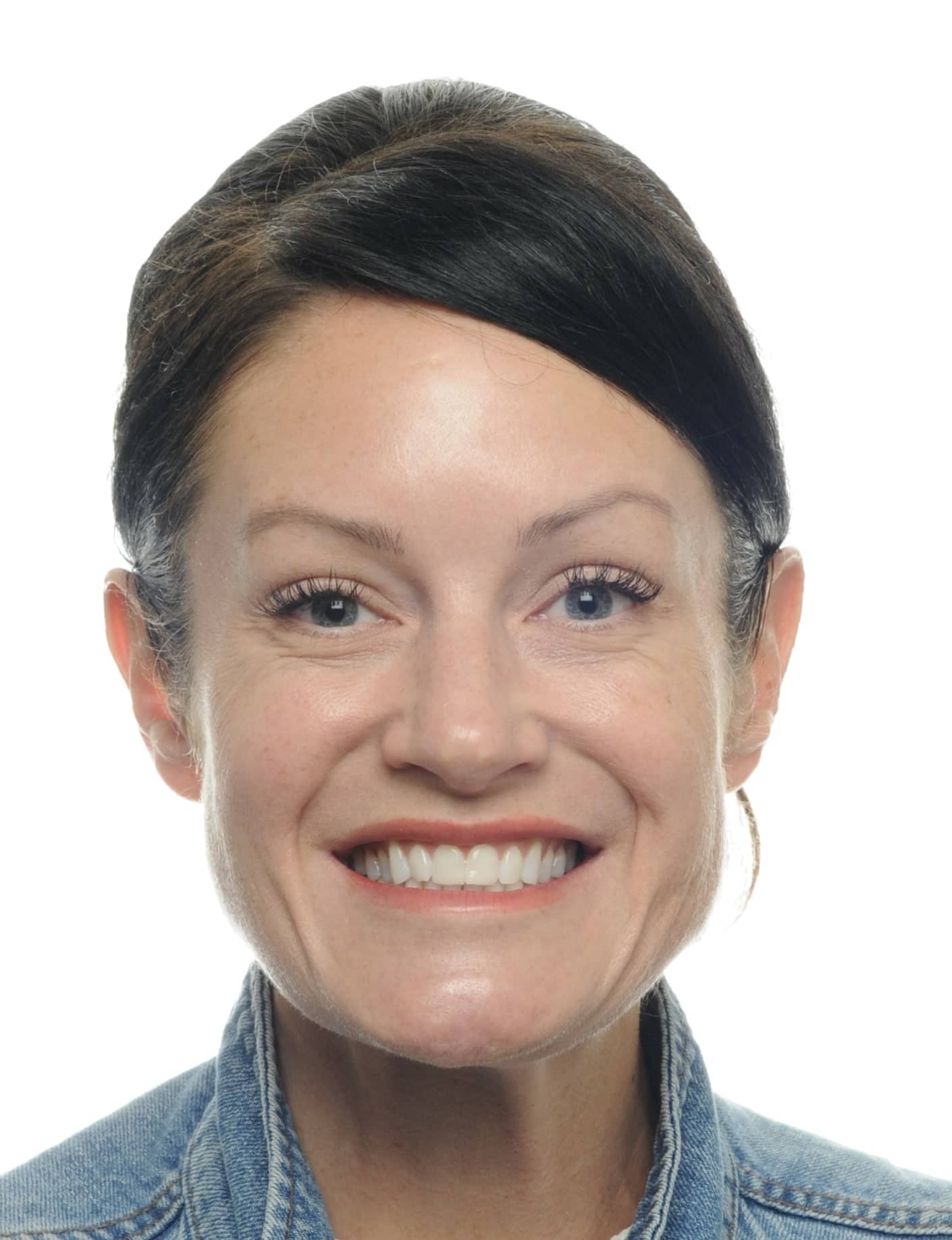 The 5 Keys to Creating Beautiful Smiles with Aligners