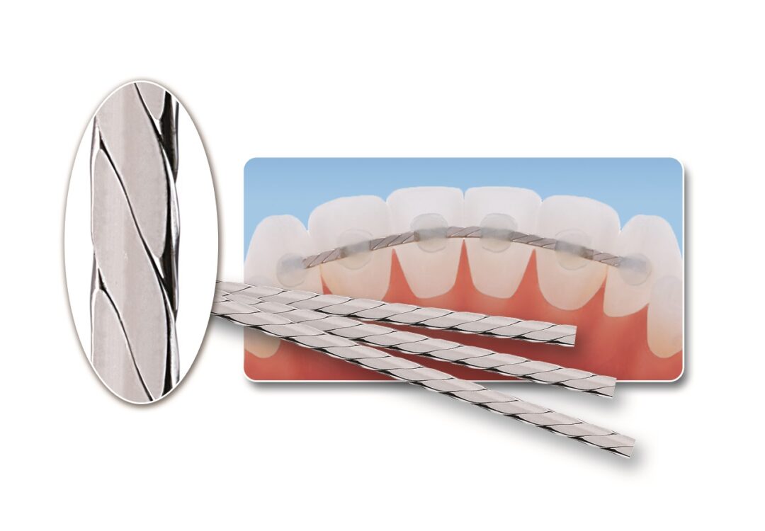 Focus On: 2022 Retainers | Orthodontic Products