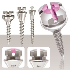 Focus On: 2022 TADs | Orthodontic Products