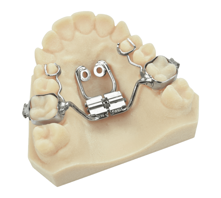Focus On: 2022 TADs | Orthodontic Products