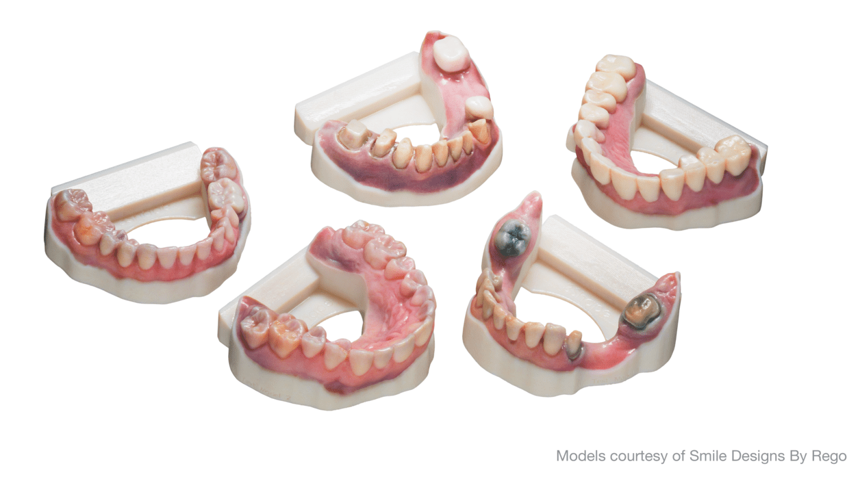 3Shape Introduces Automated Workflow for Stratasys 3D Printer