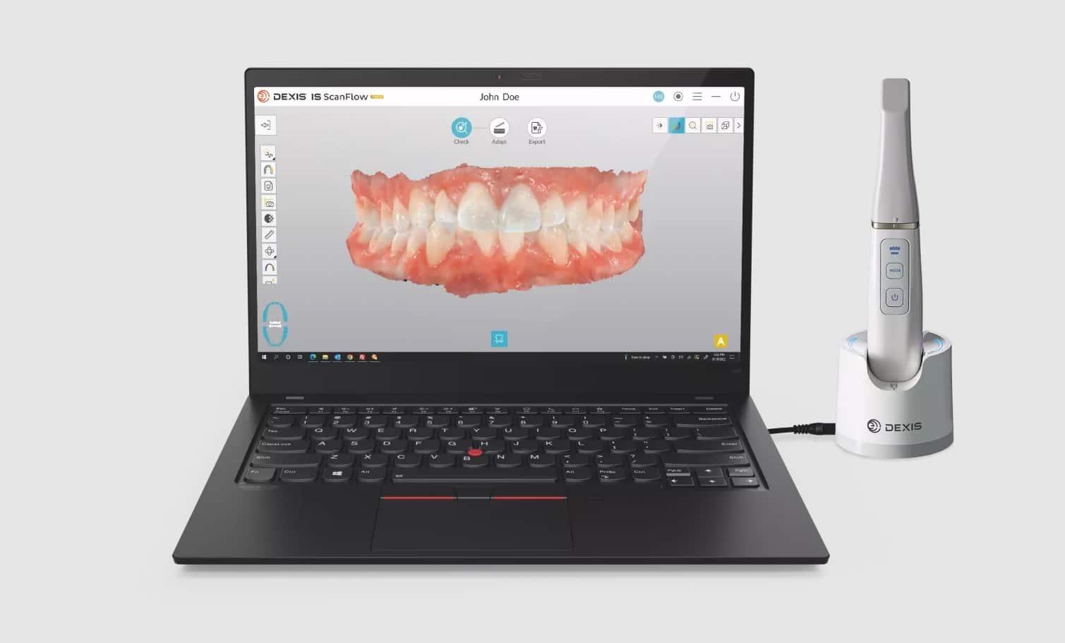 Dexis Integrates IS ScanFlow Quick Connect With EasyRx | Orthodontic ...