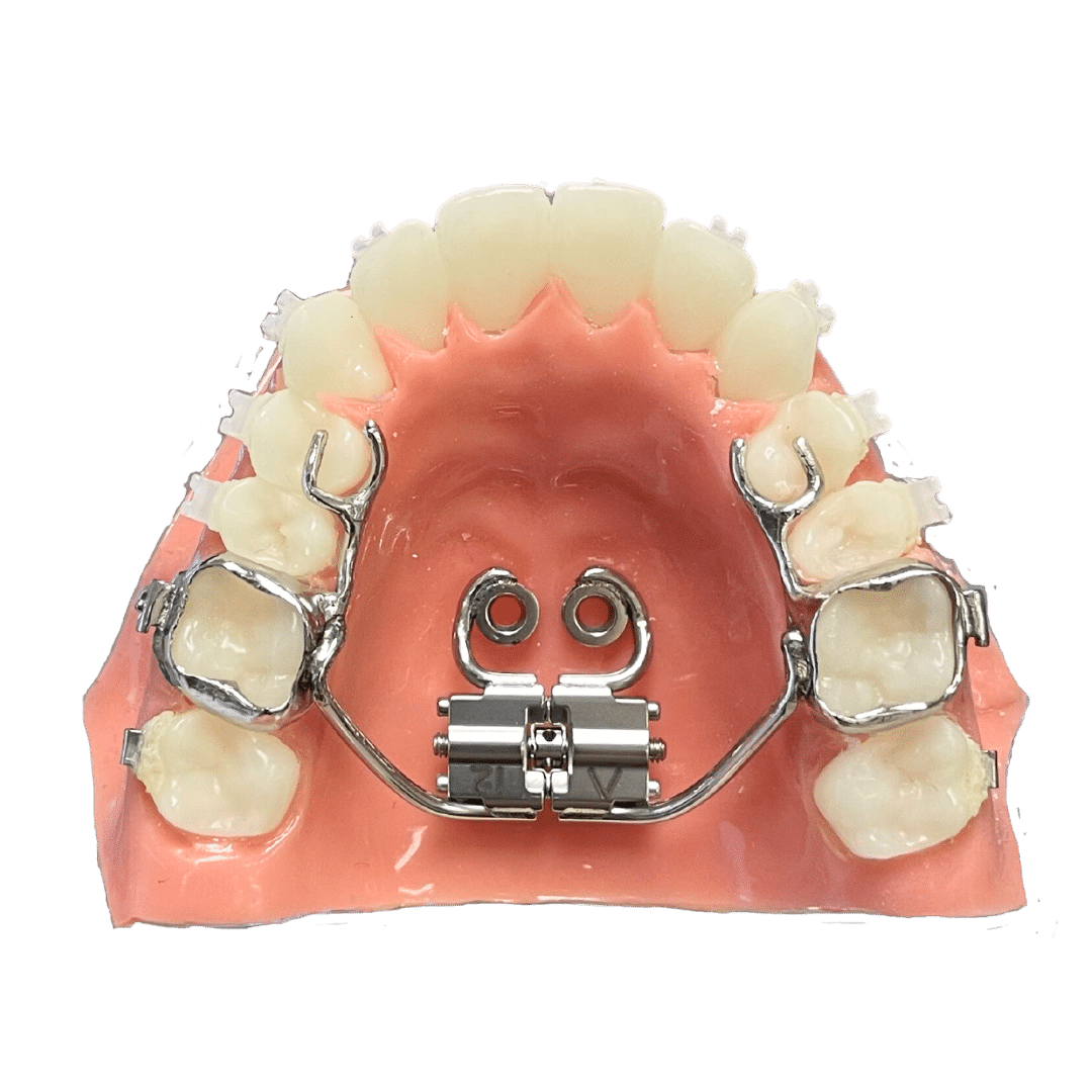 Focus On: Options for TADs in 2023 | Orthodontic Products