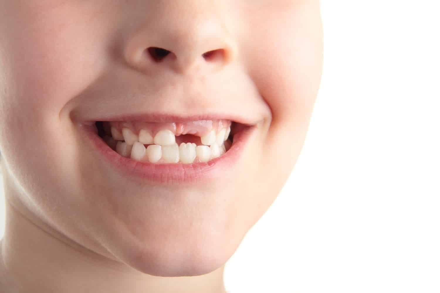 Tooth Fairy Inflation Cools for the First Time in 5 Years | Orthodontic ...