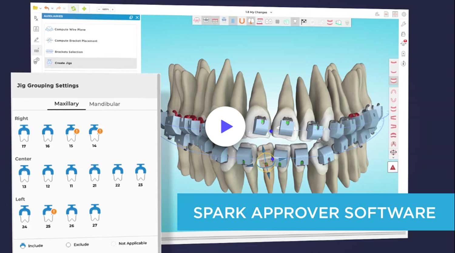 Introducing Ormco Digital Bonding, Powered by Spark Technology