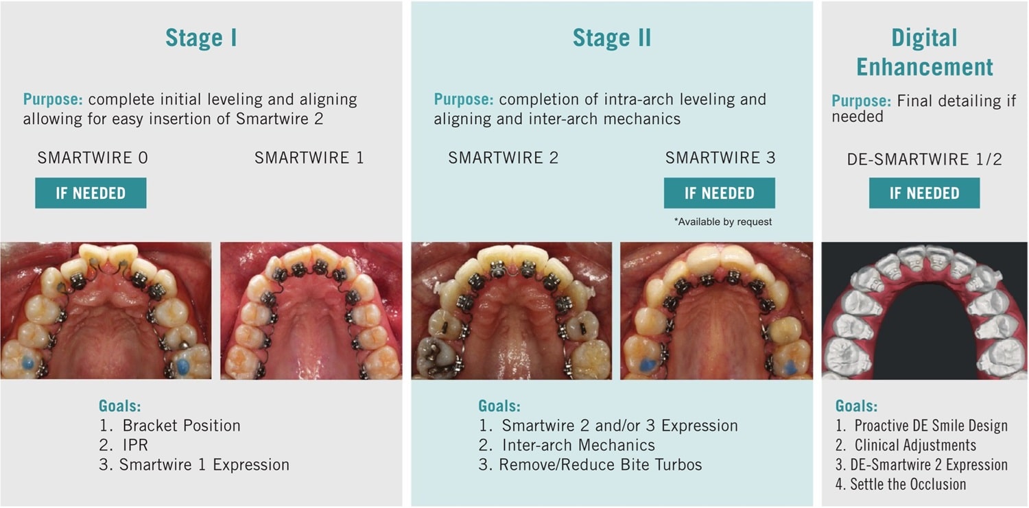 The 10 Commandments of InBrace Treatment | Orthodontic Products
