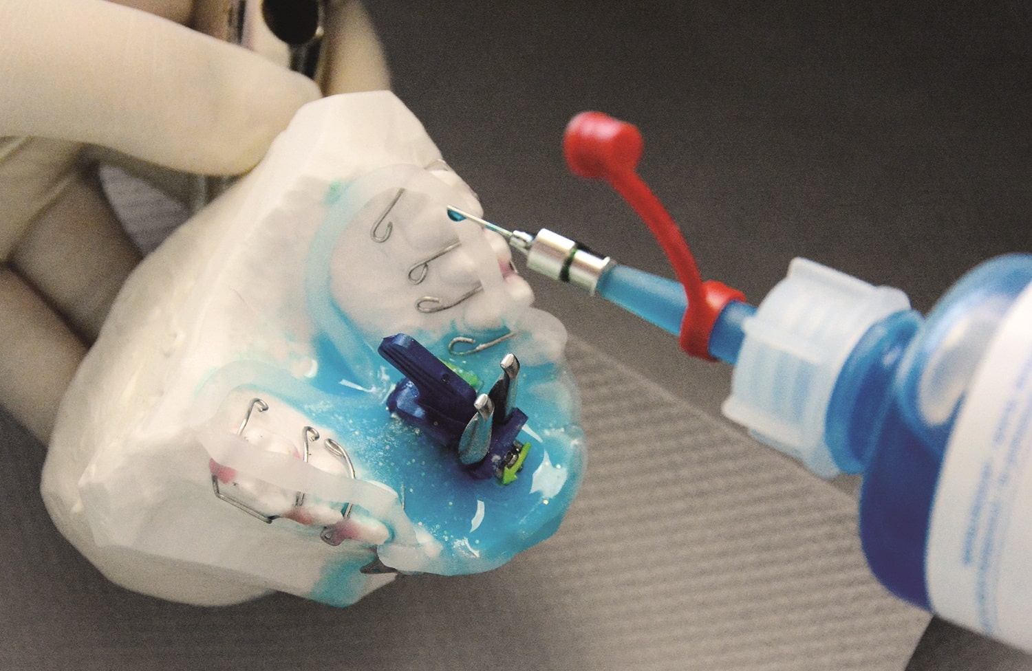 Dentaurum Celebrates 60 Years of Orthocryl | Orthodontic Products