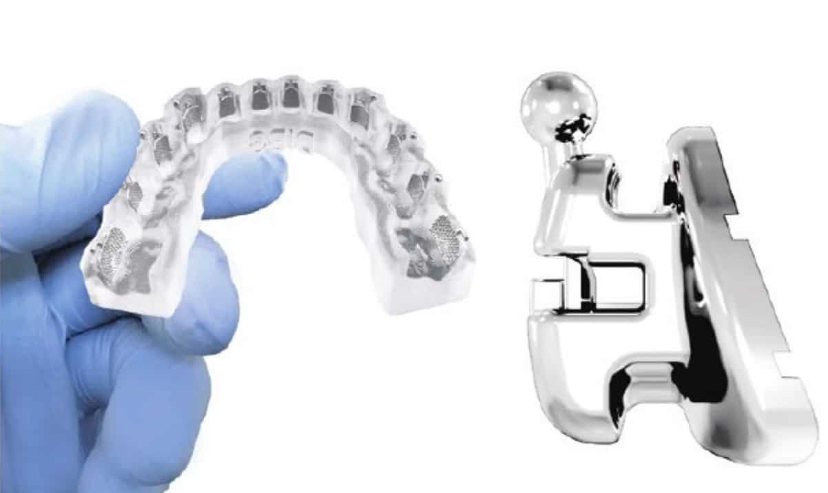 What’s New in Brackets for 2024 | Orthodontic Products