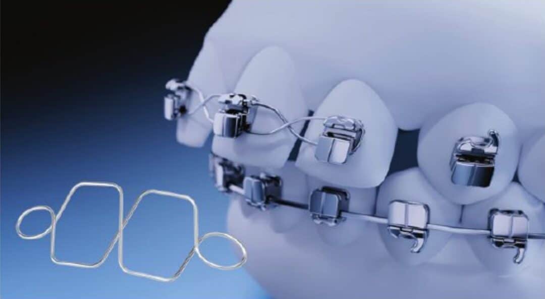 What’s New in Brackets for 2024 | Orthodontic Products