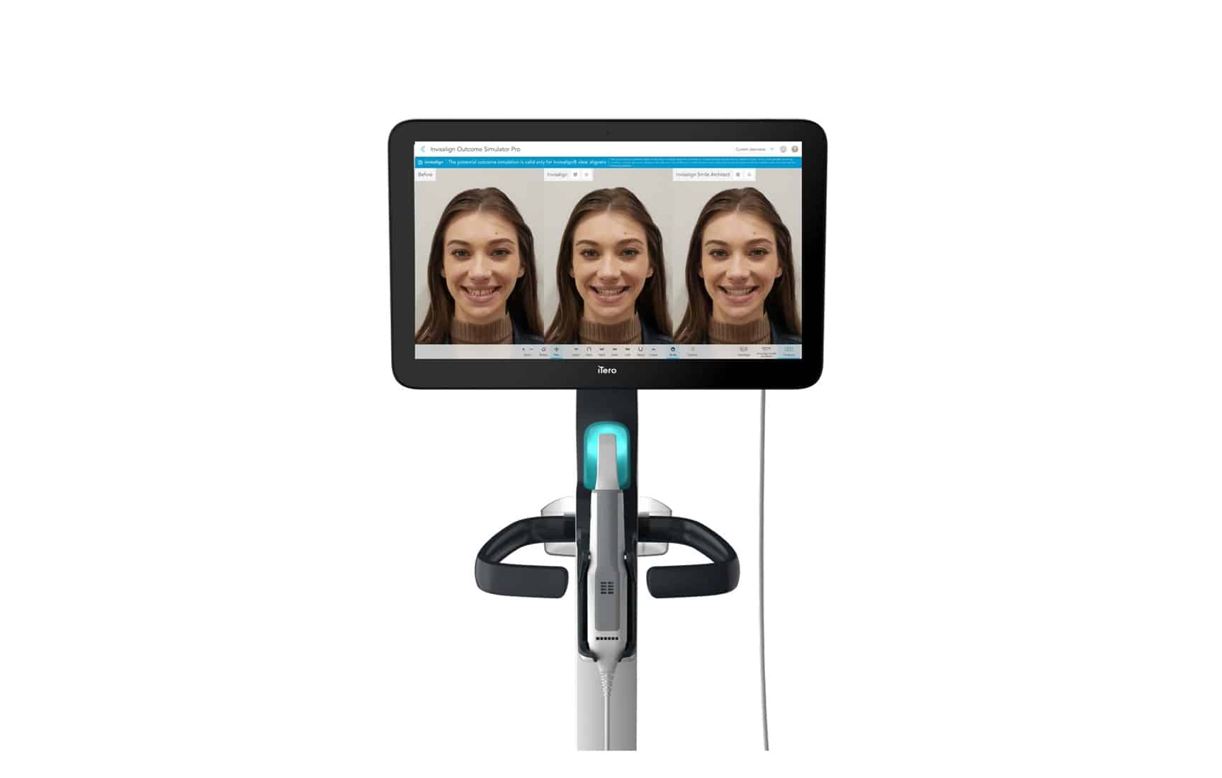 Align Technology Introduces Multiple Treatment Plans Feature ...