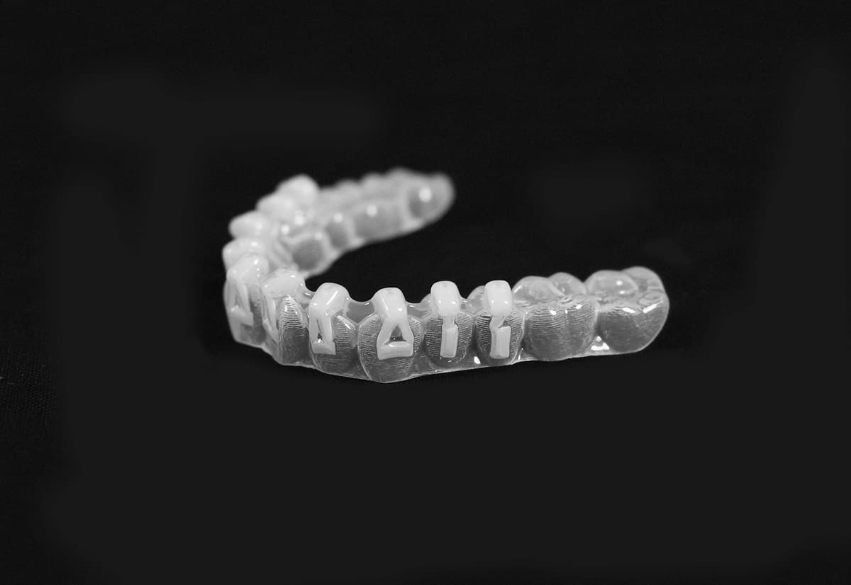 Solventum Launches 3M Clarity Precision Grip Attachments | Orthodontic ...