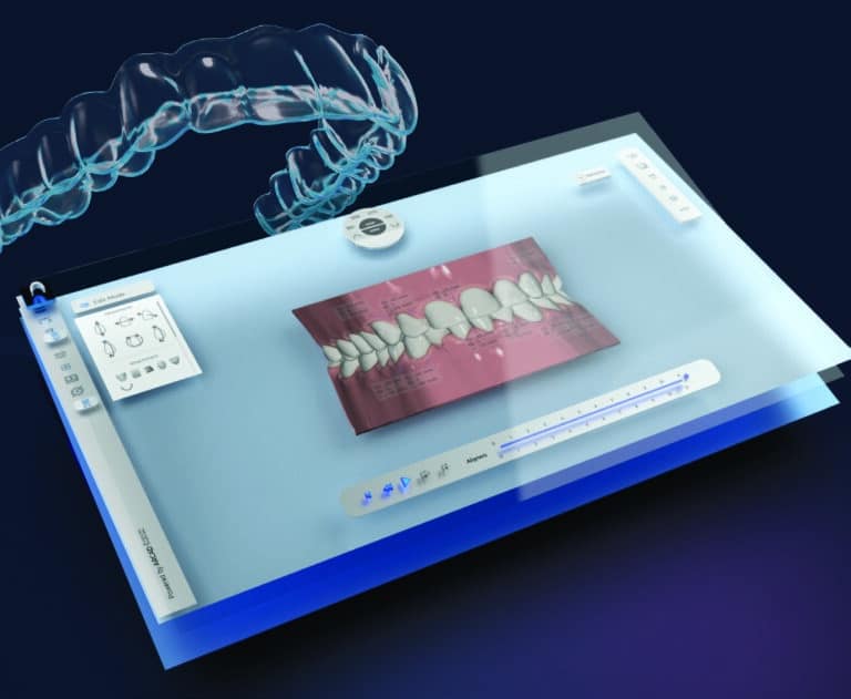 Industry Insider: Checking in with Allure Ortho | Orthodontic Products